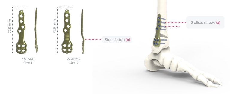 ActivMotion S-DTO - DBM Medical Group - Distal Tibial Osteotomy