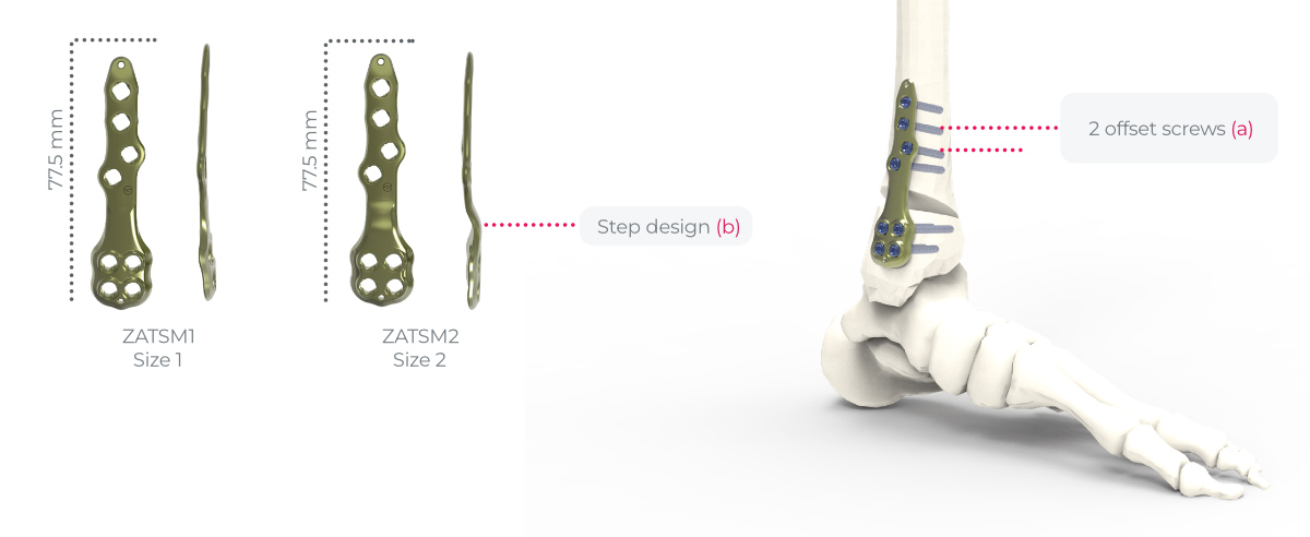 Activmotion S Dto Dbm Medical Group Distal Tibial Osteotomy