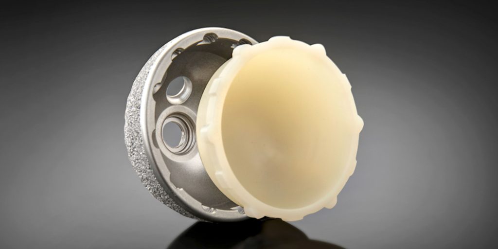 Alteon® Acetabular Cup and XLE Liner - DBM Medical Group